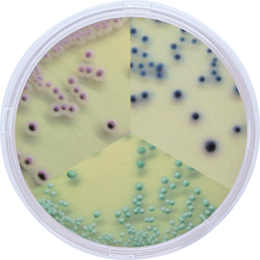 CANDIDA CHROMOGENIC AGAR | Agarindo Biological Company