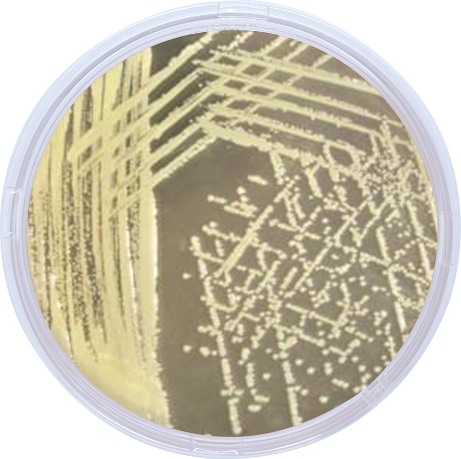 STANDARD METHODS AGAR (PCA) | Agarindo Biological Company