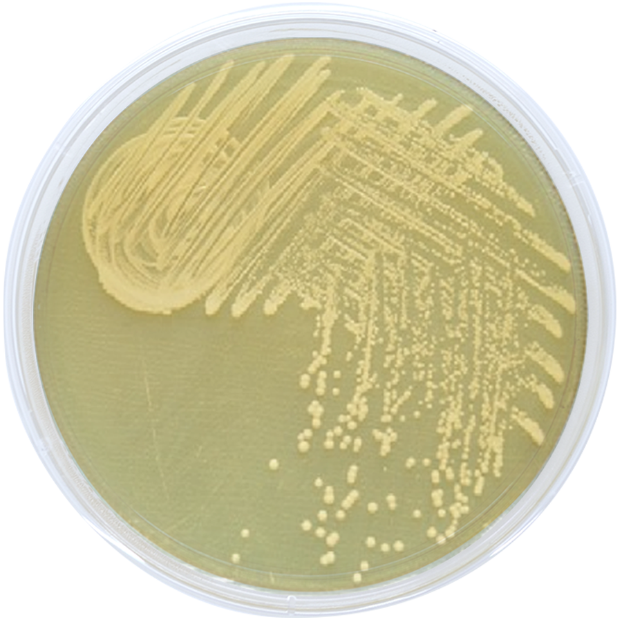 BRAIN HEART INFUSION AGAR | Agarindo Biological Company